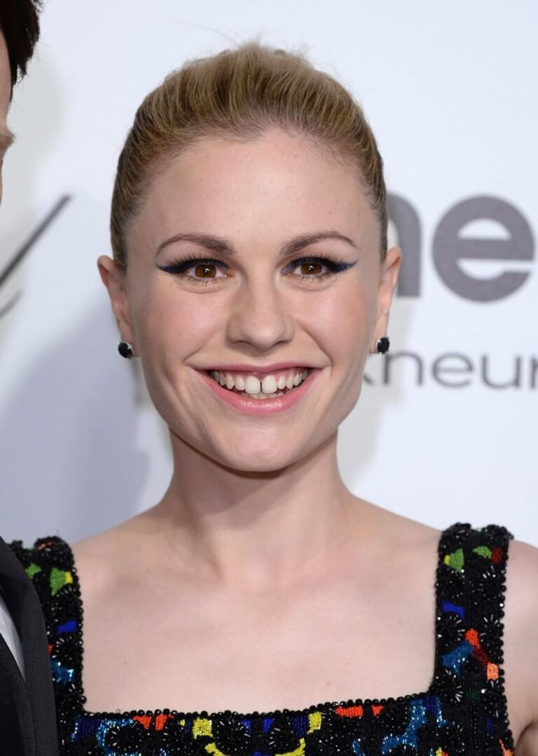 15 Stars Who Chose Not To Fix Their Teeth For The Camera - On Your Journey
